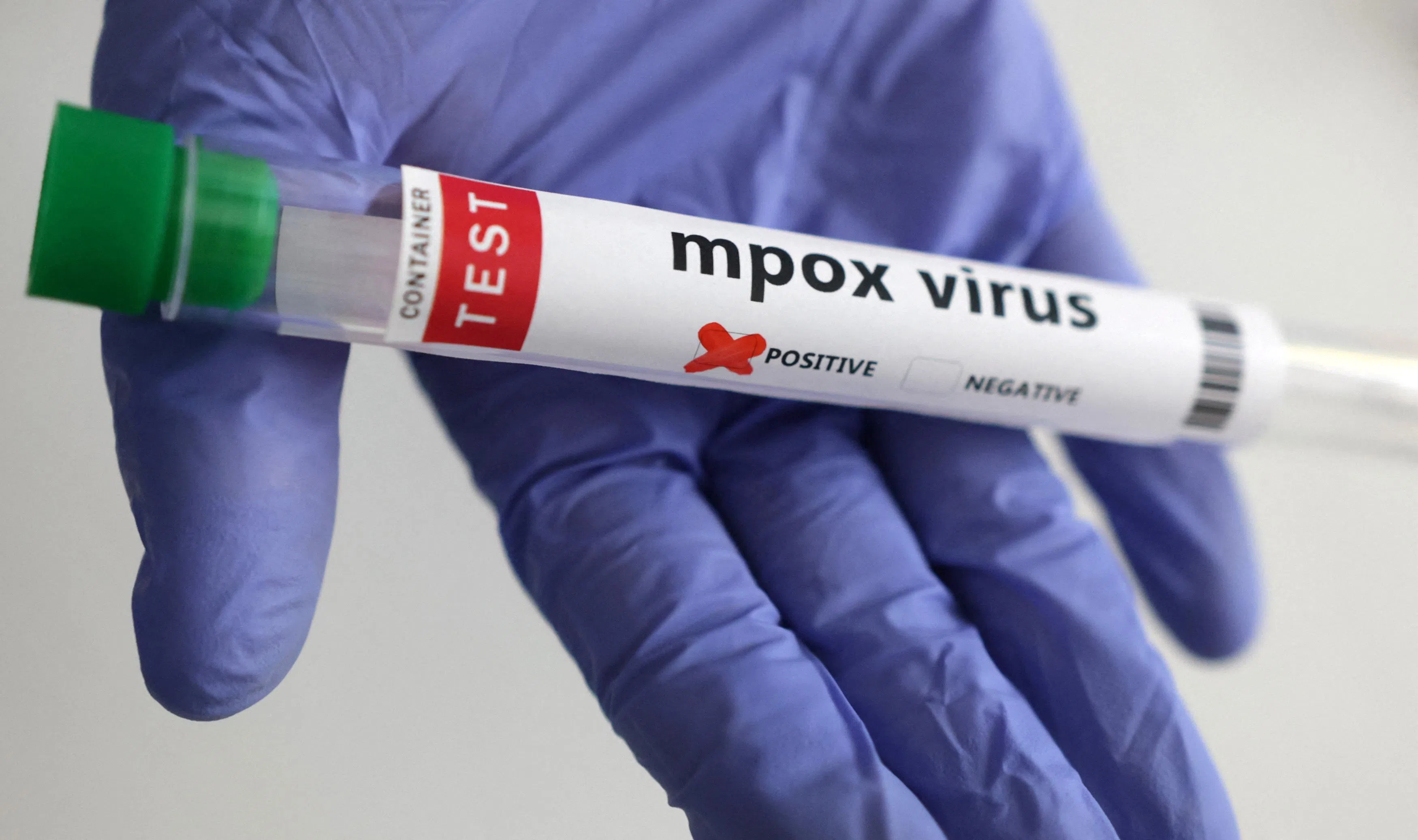 WHO approves first mpox diagnostic test for emergency use - The ...
