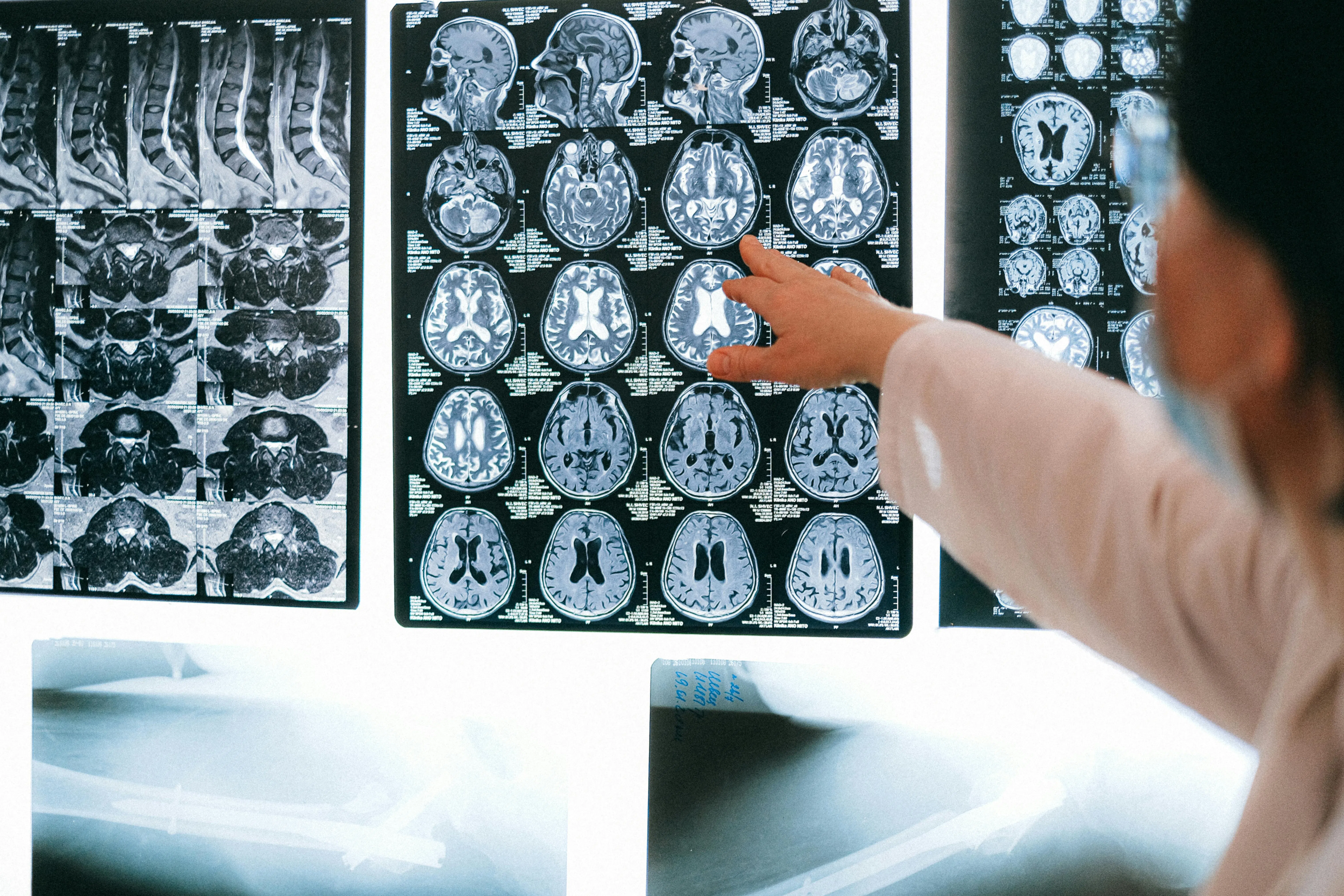 Revolutionising medical imaging: A new era - The Business Times
