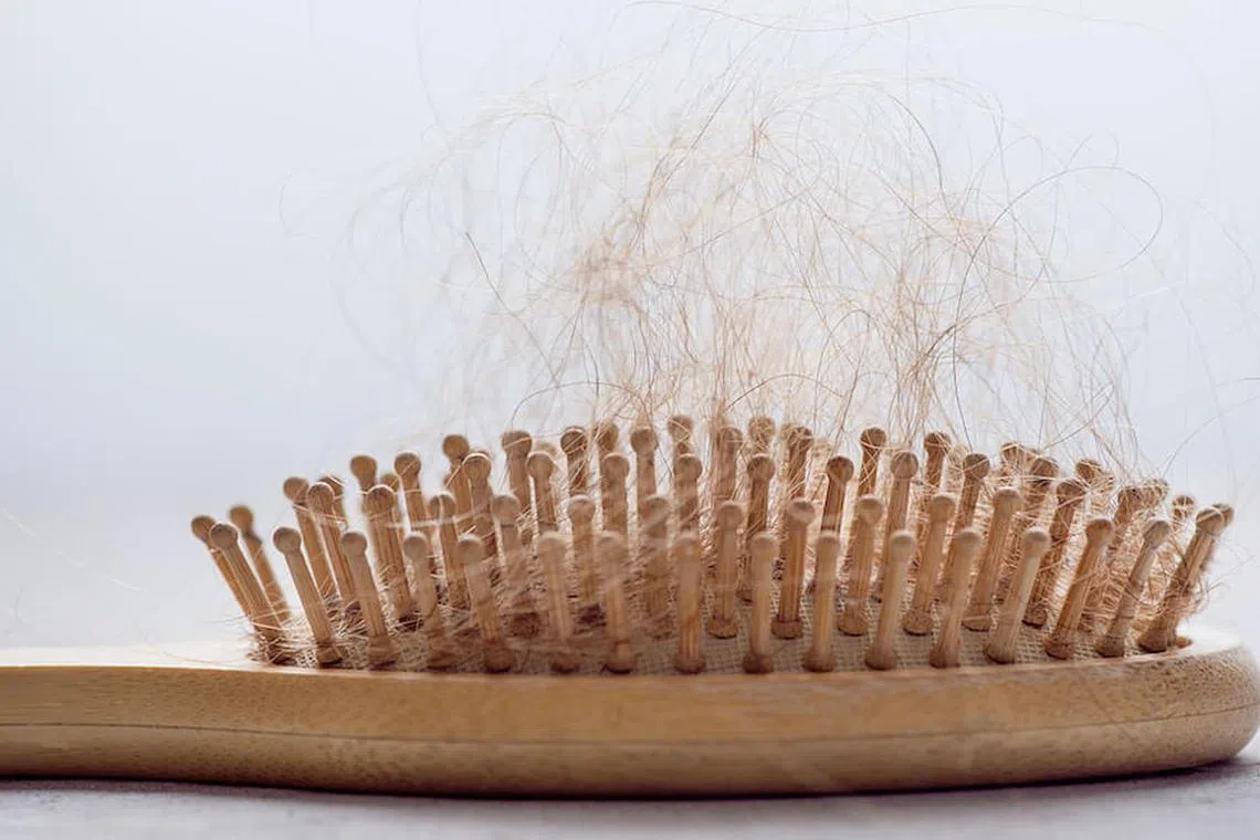 What Causes Balding And What Can You Do About It | Harper's Bazaar ...