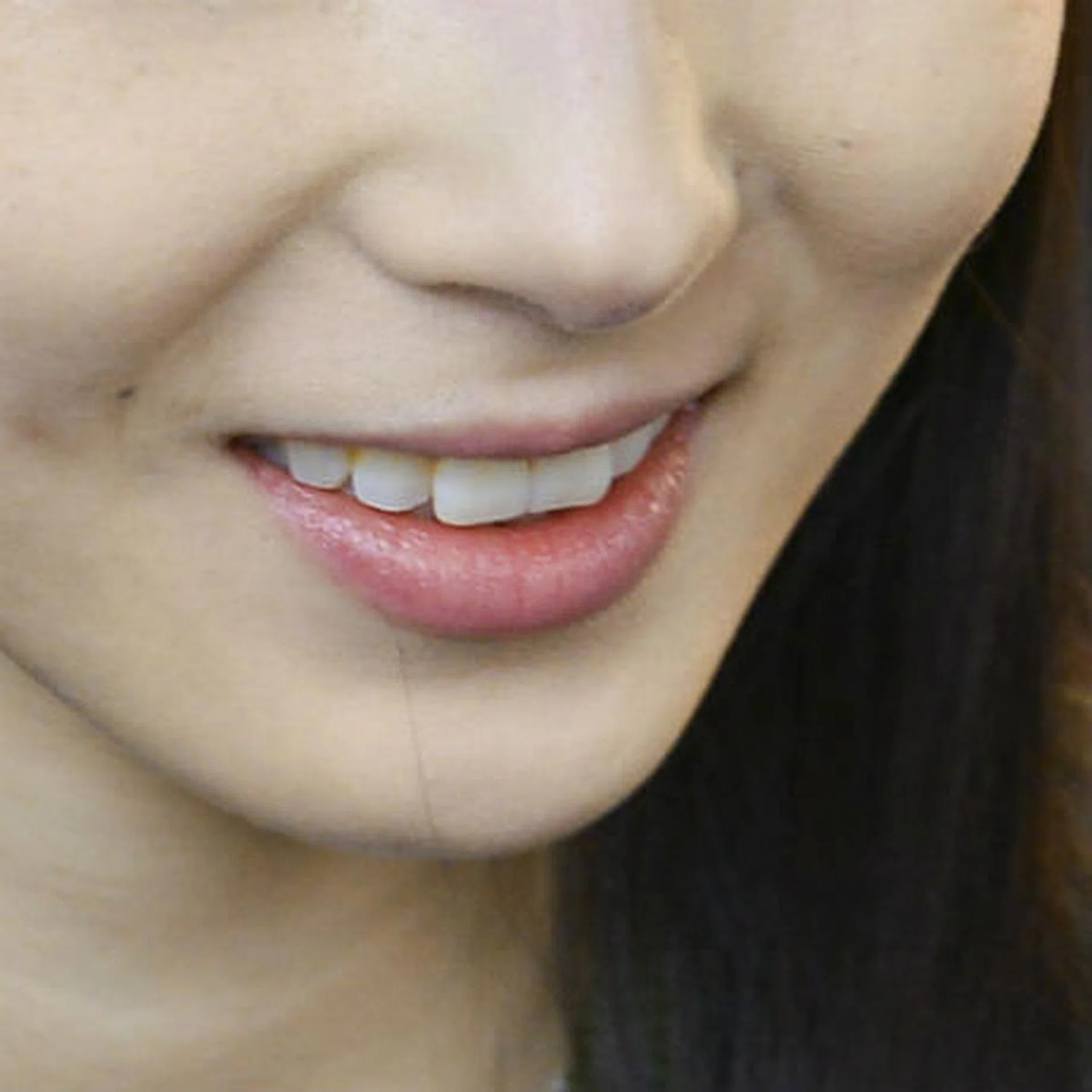 7 tips for clean and sparkly teeth - Her World Singapore | Her World ...