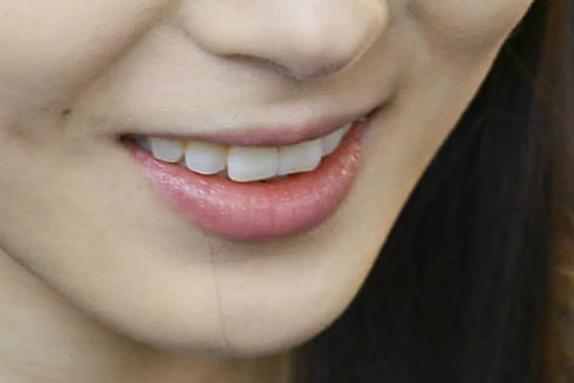 7 tips for clean and sparkly teeth - Her World Singapore | Her World ...