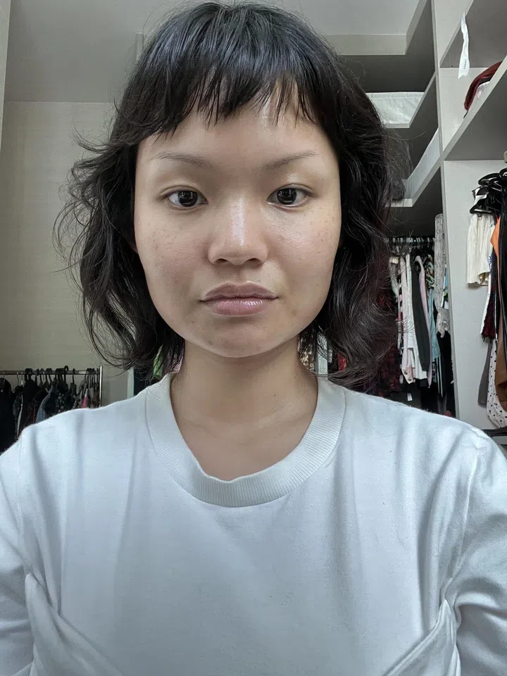 Face Cupping Is It Worth The Hype | Her World Singapore