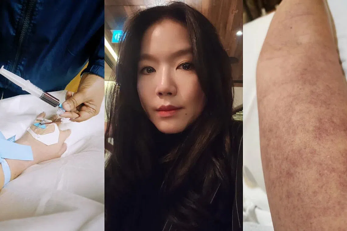 Rui En's near-death experience with deep vein thrombosis | Her World ...