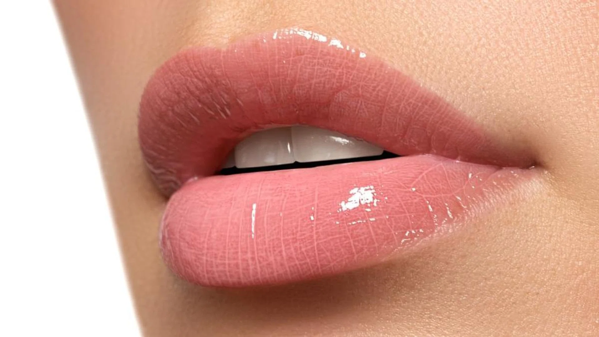 Ask The Expert: Can lip fillers fix chronically dry lips? - Her World ...