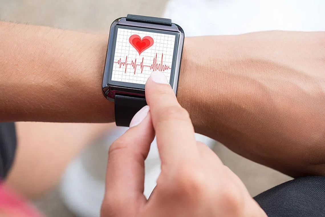 Health gadgets that are actually worth your money - Her World Singapore ...