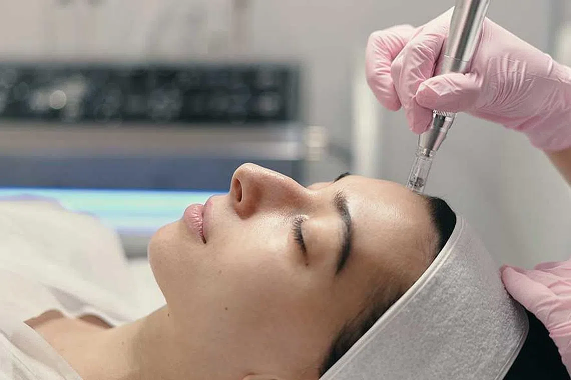 Everything You Need To Know About Skin Needling, Microdermabrasion And ...