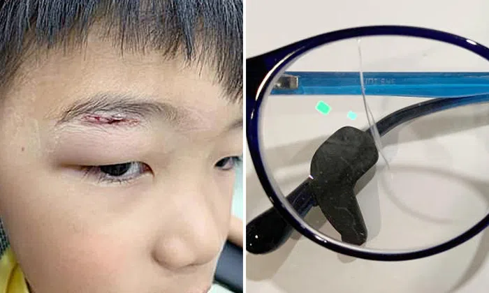 8-year-old boy suffers cut above eye while playing at Jewel's Canopy ...