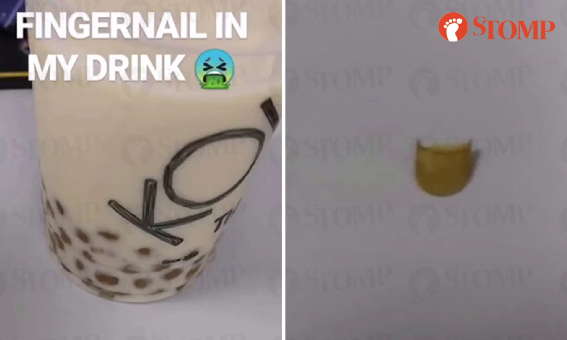 KOI apologises after customer bites on yellow..., Latest News - STOMP