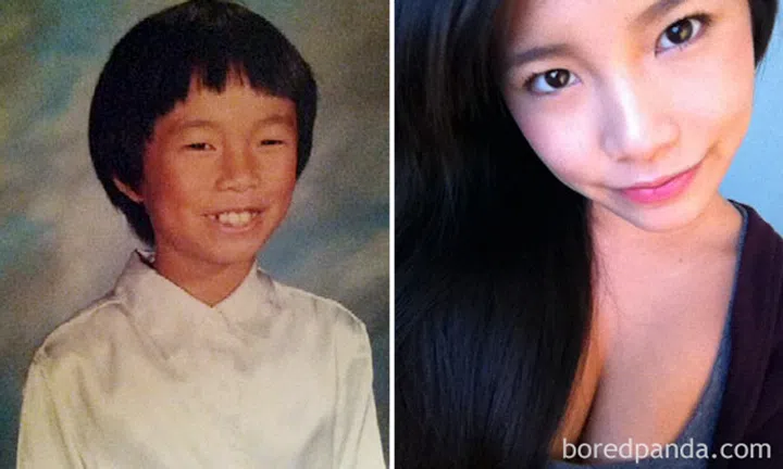 Dramatic 'ugly duckling' transformations that you won't believe are ...