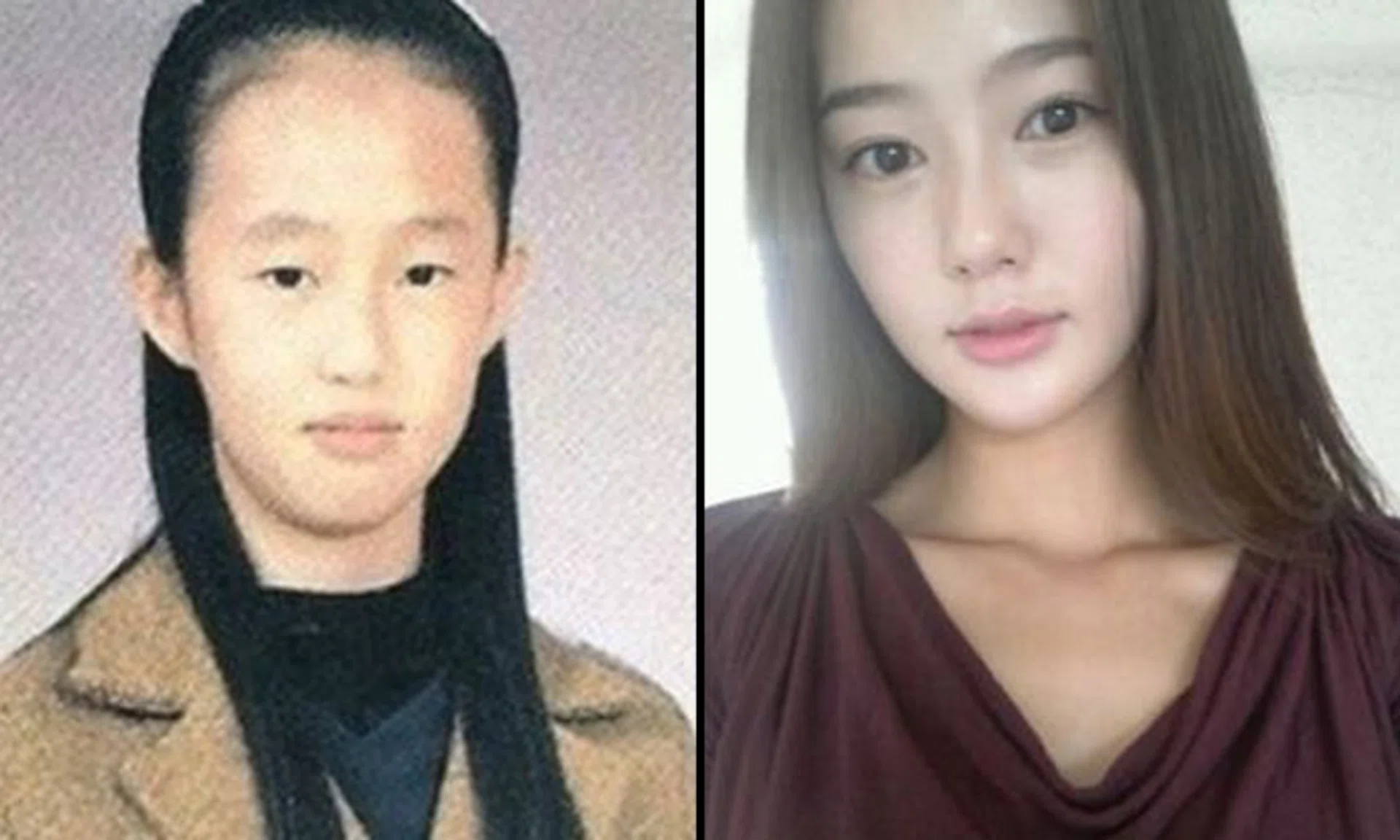 31 dramatic photos that show how plastic surgery can turn you from ...