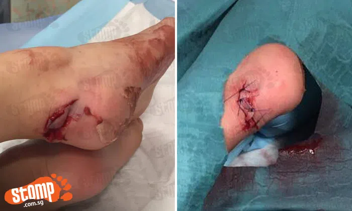2-year-old girl's ankle badly cut and 'dripping blood' while riding ...