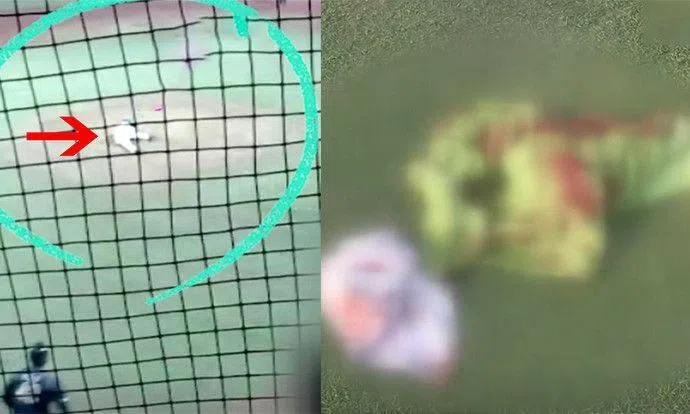 Actor's face severely injured after getting hit by baseball he pitched ...