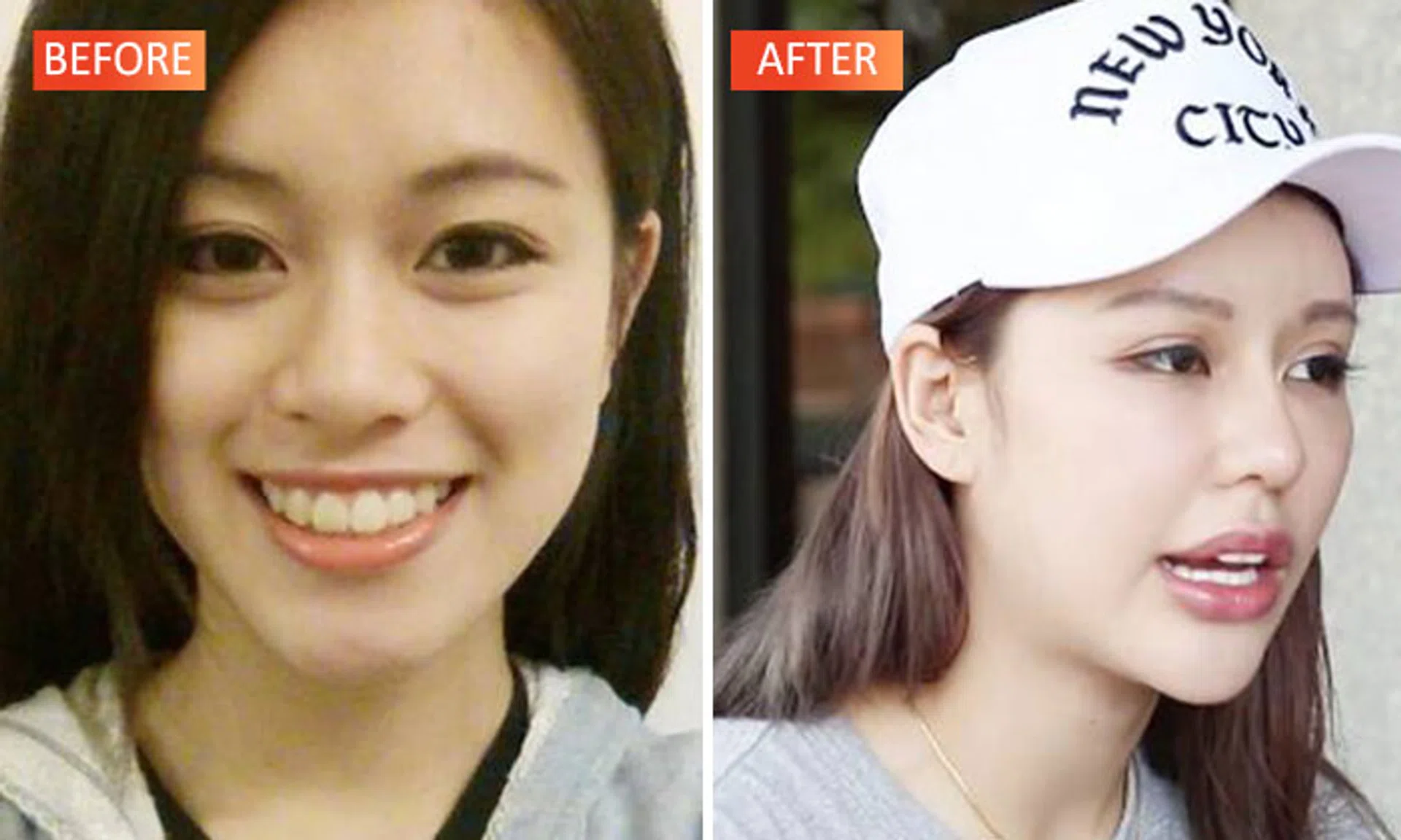 She was already pretty, but YouTube star had plastic surgery over 30 ...