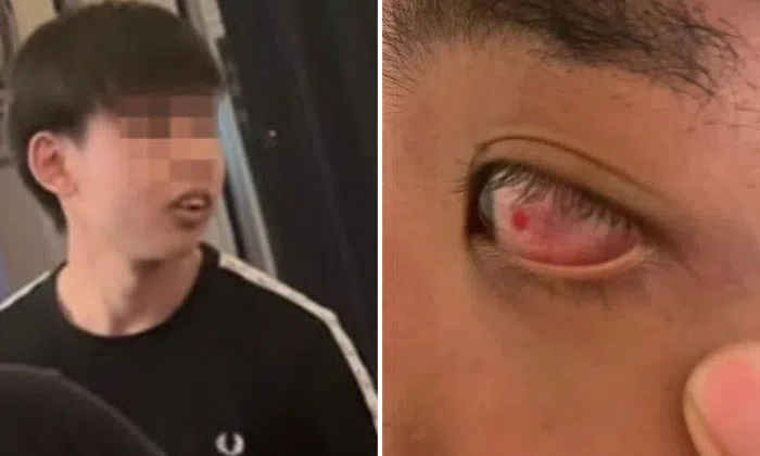 International student claims he was punched in the eye at Chijmes toilet and was momentarily ...