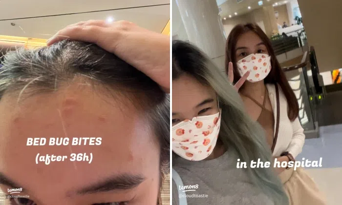 Woman gets bed-bug bites on face in Bangkok, sends hospital bill to ...
