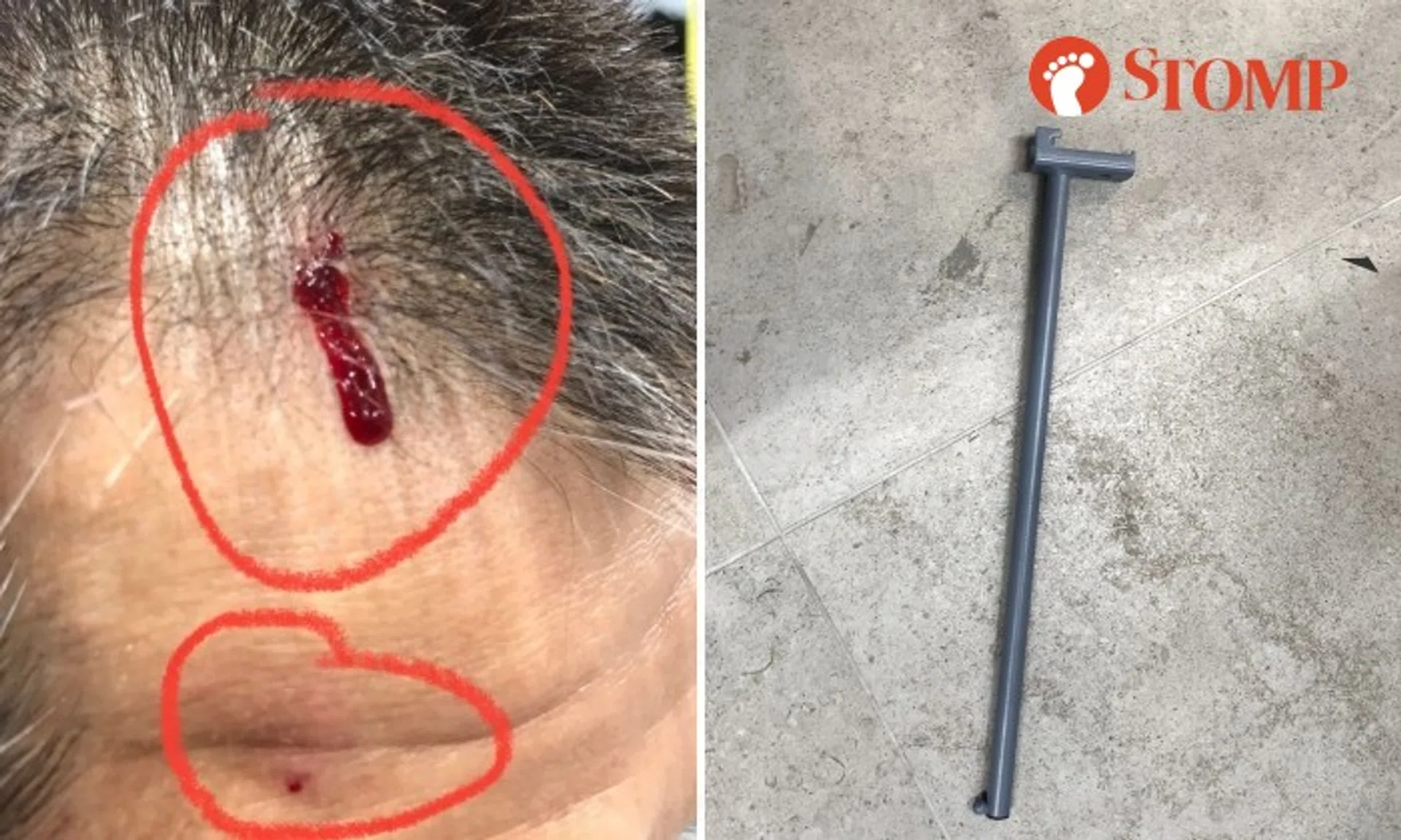 Man hurt after metal rod falls on him in JB Decathlon, rushes back to S ...