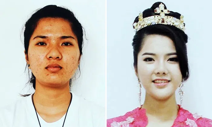 Woman's dramatic transformation proves that there's nothing plastic ...