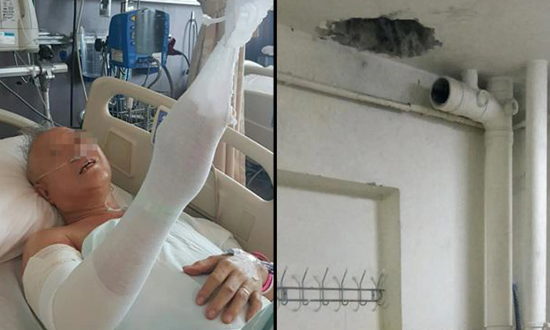 67-year-old uncle's hand stuck in water pipe for 6 hours after trying ...