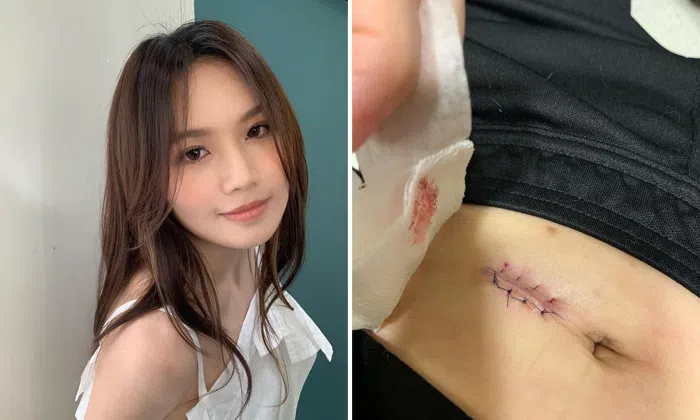 Boon Hui Lu suffering from painful cysts for over 10 years, broke down after recent surgery | STOMP