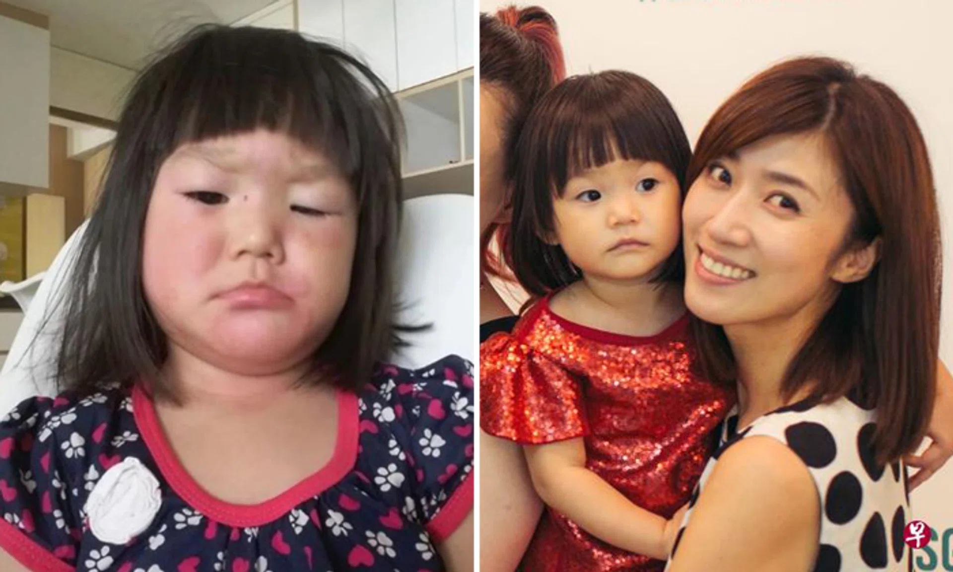 Andie Chen and Kate Pang's daughter suffers..., Latest News - STOMP