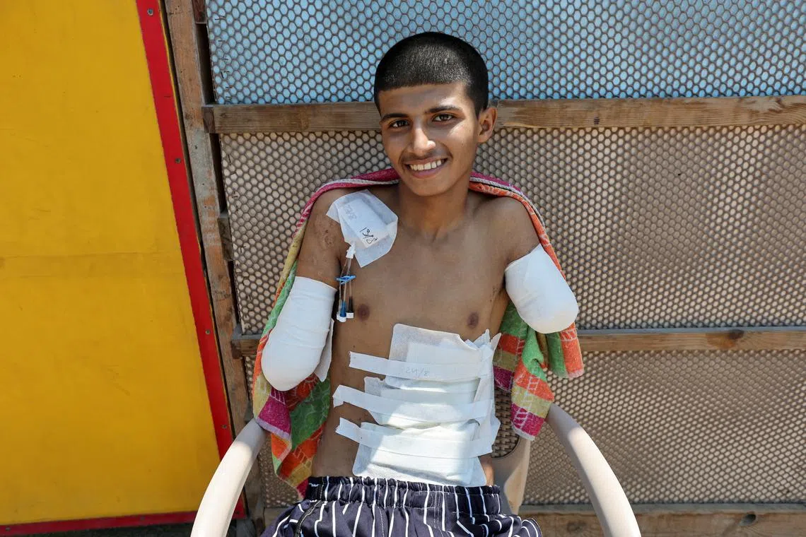 Gaza teen amputee recalls nightmare of losing arms in Israeli strike ...
