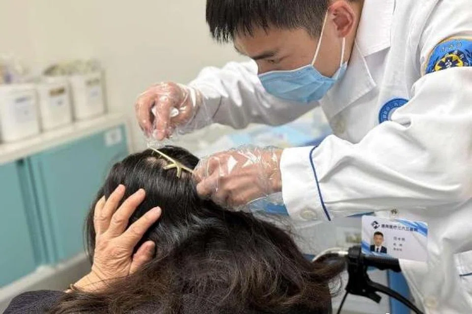 Hair claw clip pierces woman’s head after traffic accident in Chengdu ...