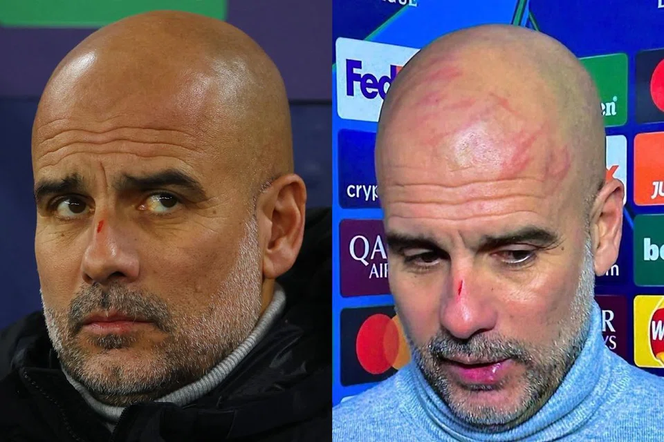 Manchester City boss Pep Guardiola clarifies comments after self-harm ...