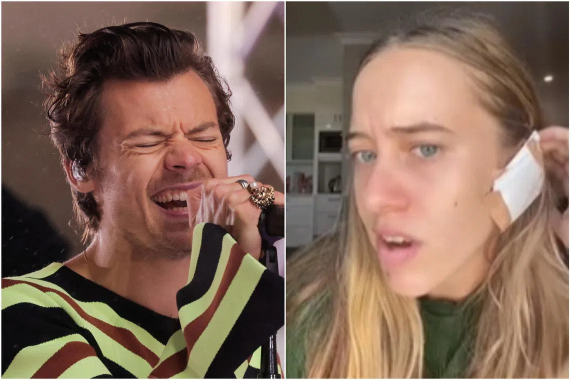 Going to Harry Styles’ concert? Earplugs may come in handy after ...