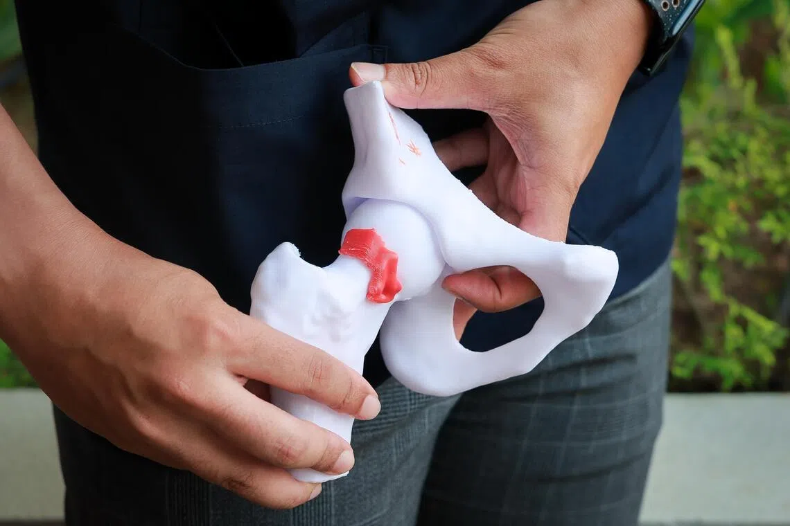 Why more younger people in Singapore are seeking help for hip pain ...