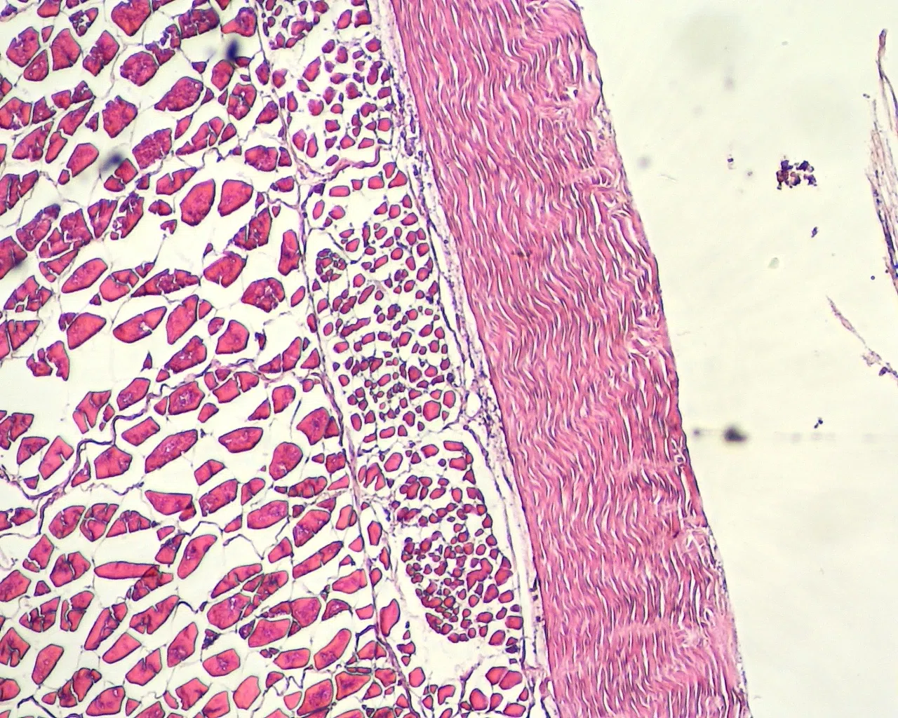 Philippine researchers say milkfish skin can be used to treat severe ...