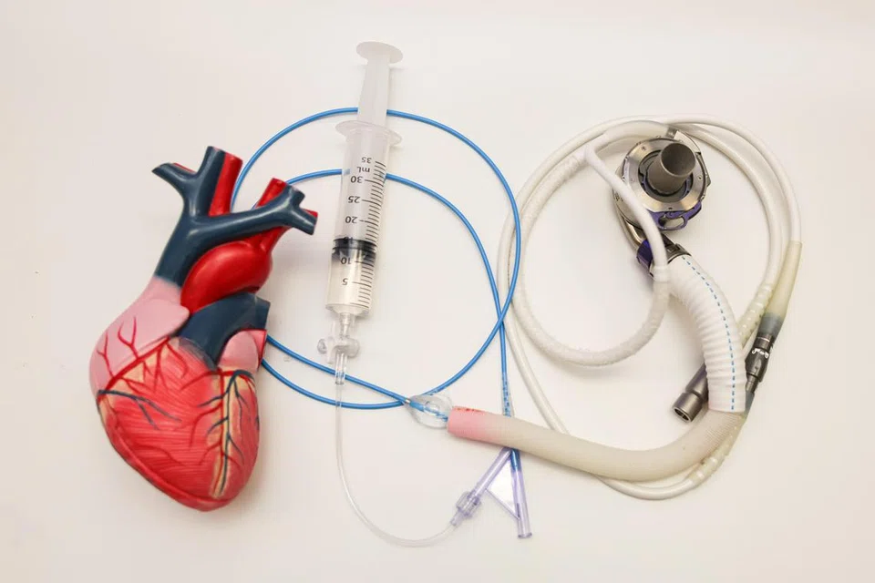New, less invasive procedure used in Singapore to solve blockage in ...