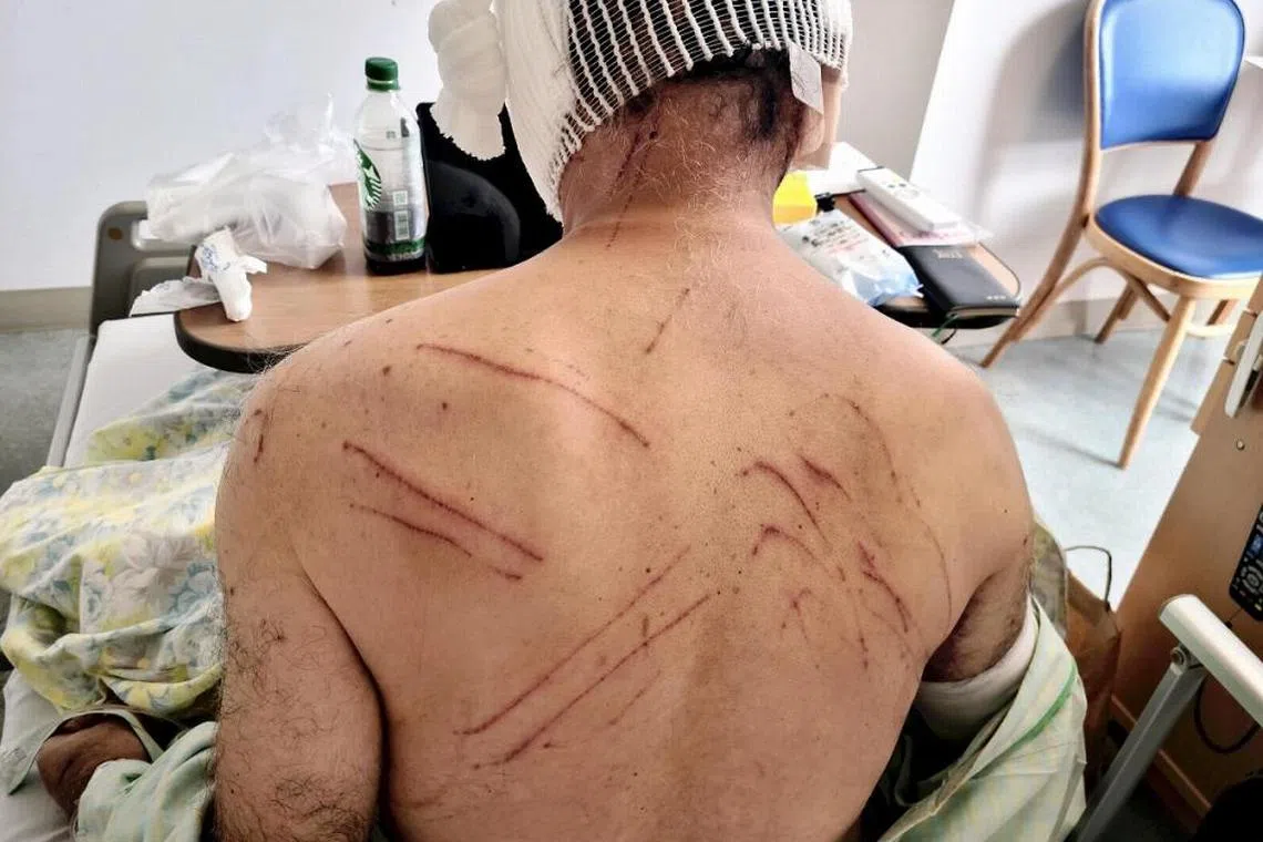 ‘The bear bit down on my head’: Japanese man recalls horrifying bear ...