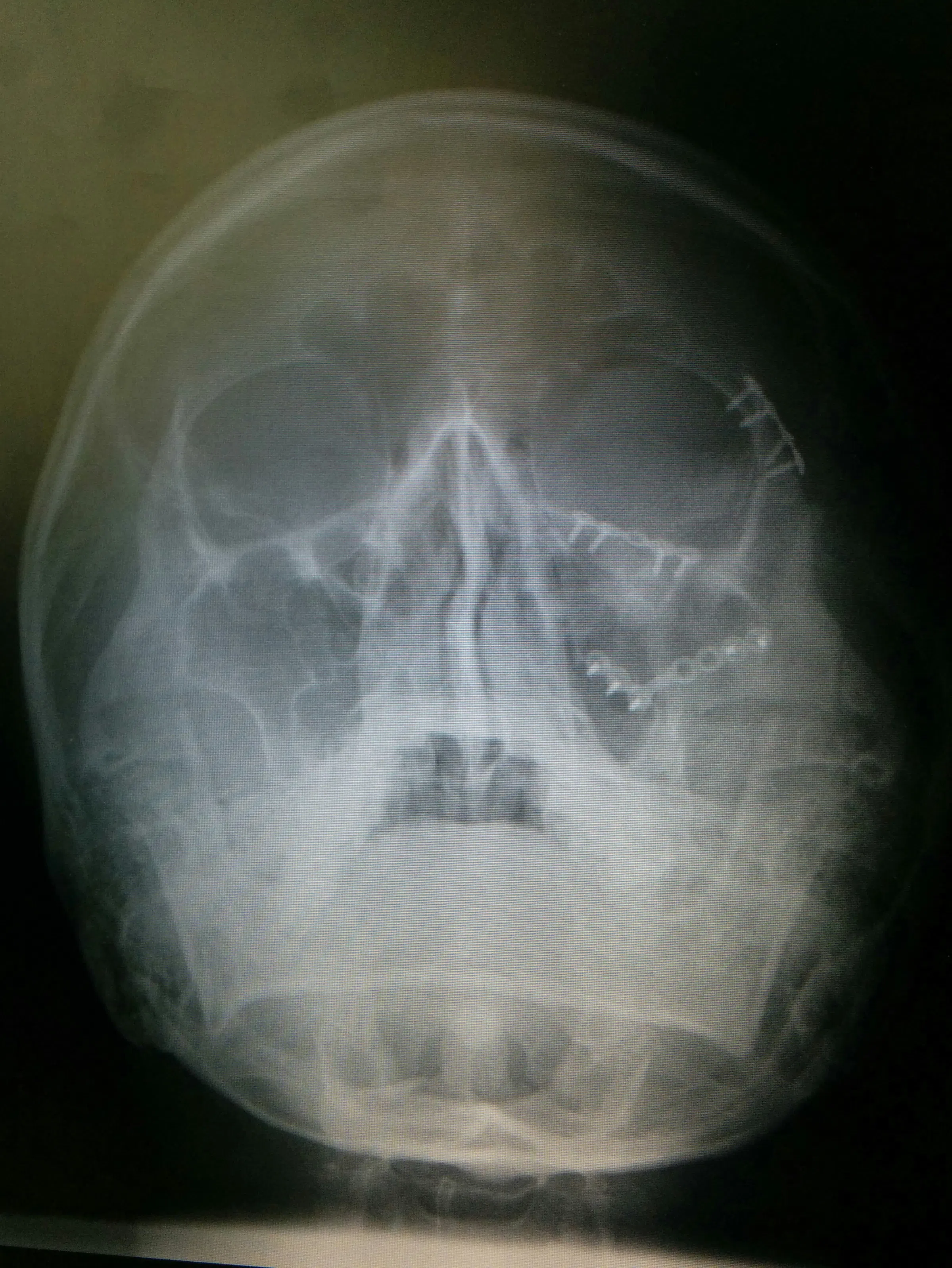 Man bashed for calling club bouncer fat | The New Paper