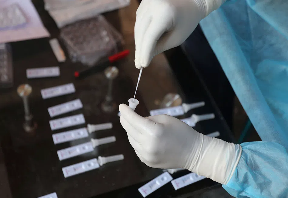 Coronavirus capable of invading brain: Study | The New Paper
