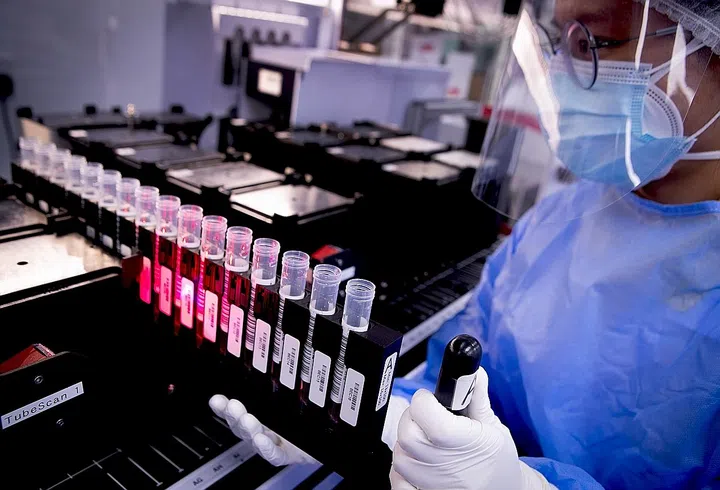 Labs here working at over 80% capacity as number of Covid tests jumps ...