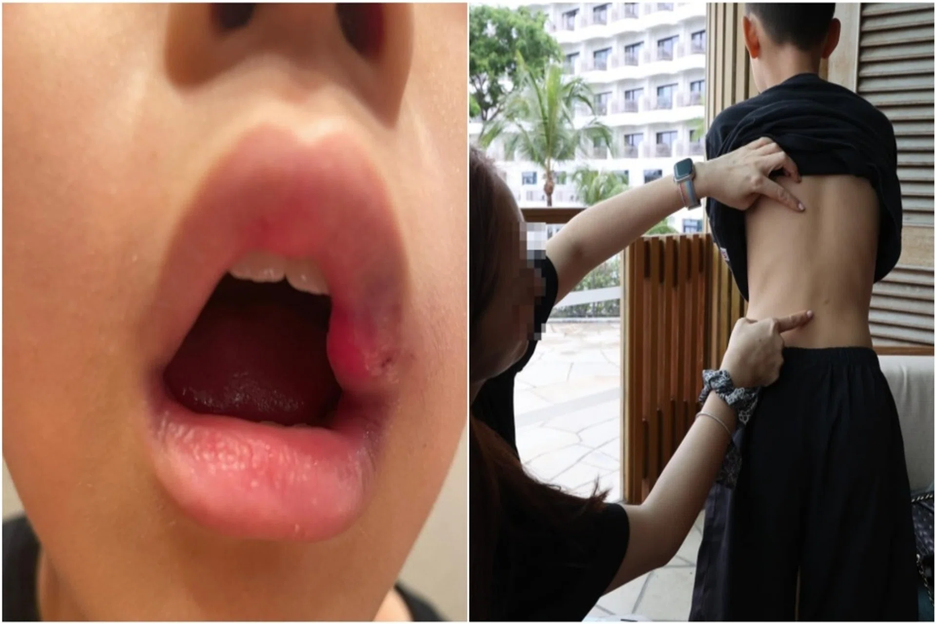 Boy allegedly gets punched by classmates after string of bullying ...