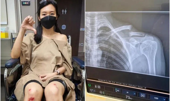 Actress Jaime Teo needs surgery after breaking collarbone in cycling accident | The New Paper