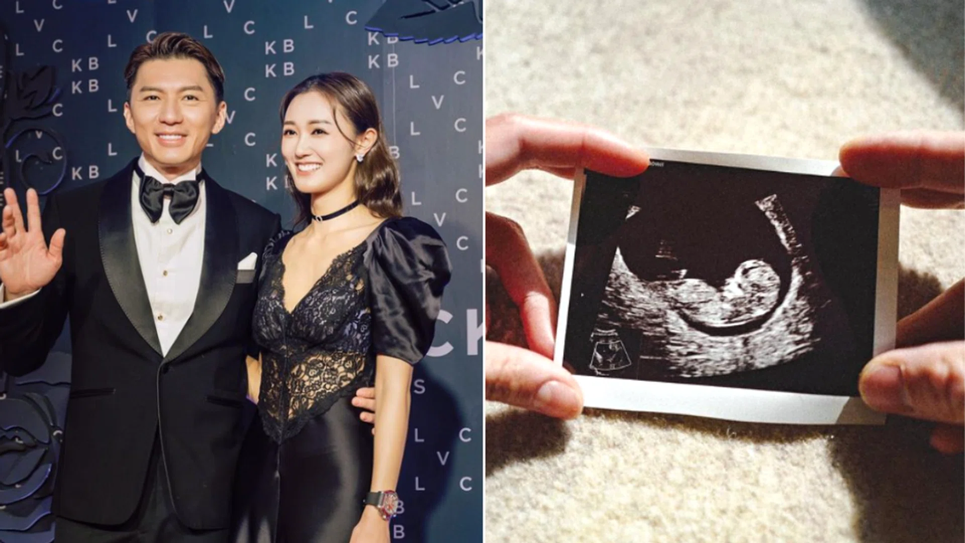 Hong Kong Celeb Couple Bowie Cheung and Benjamin Yuen To Welcome Their ...